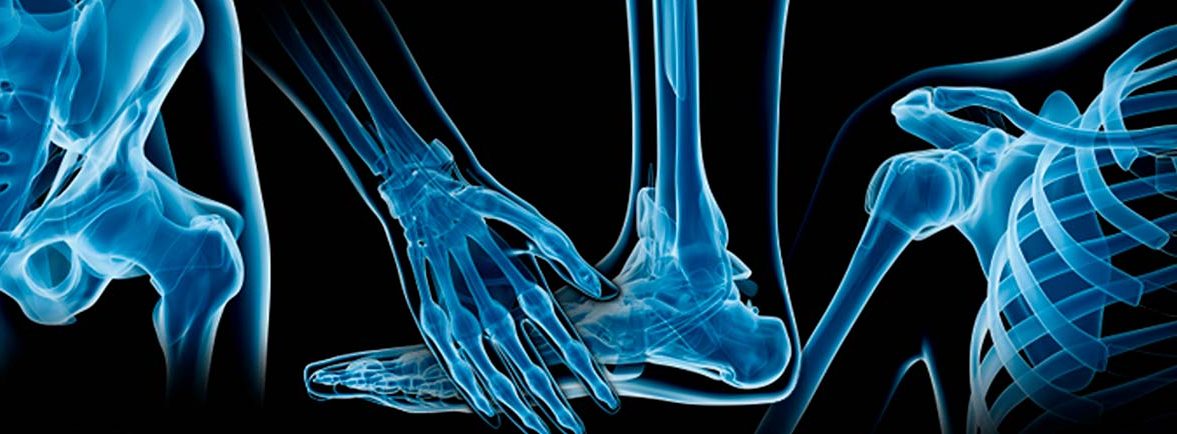 La Importancia de la Sociedad Latinoamericana de Ortopedia y